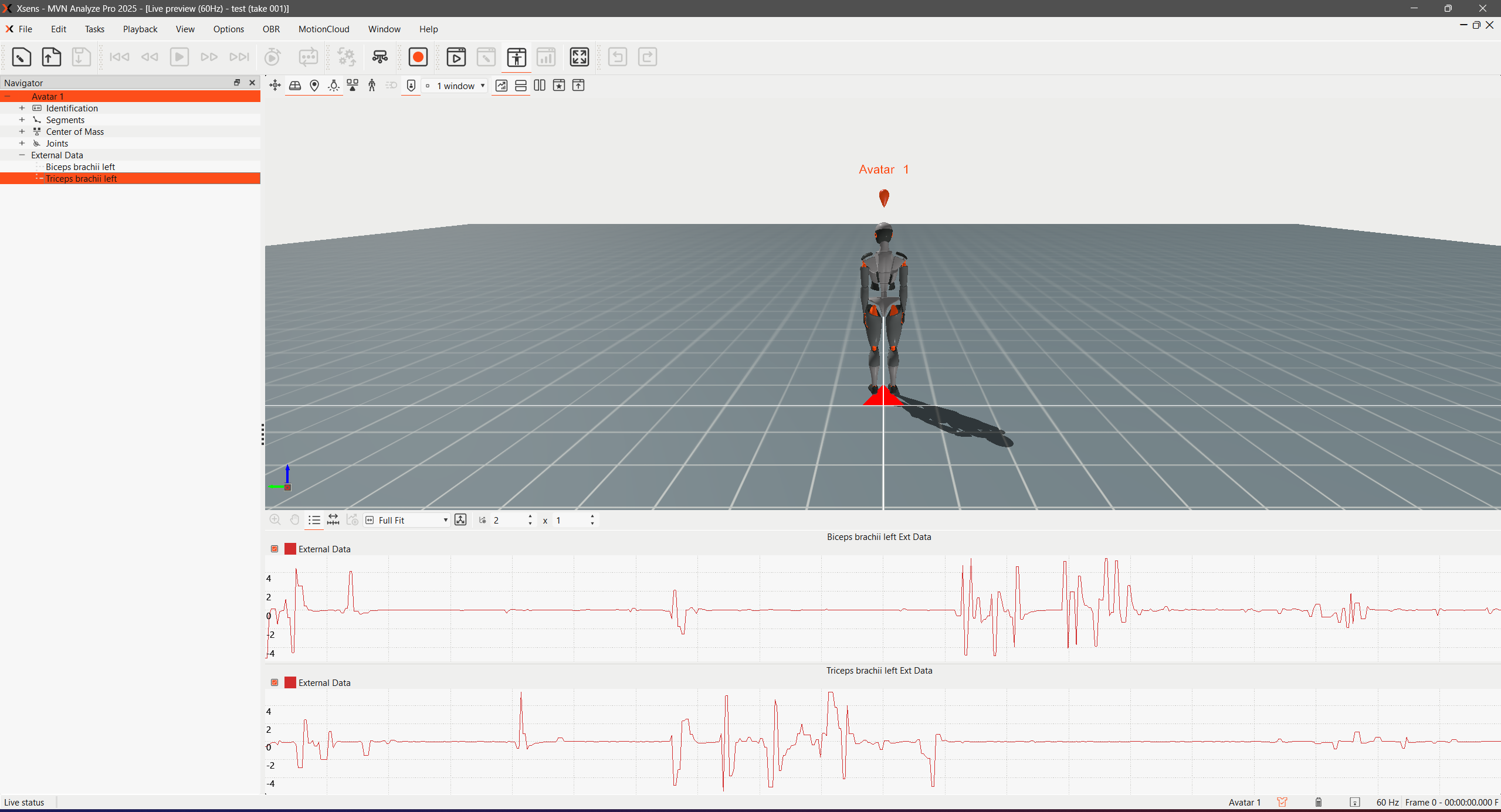 EMG Integration in Xsens Analyze